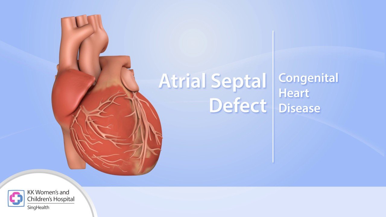 Atrial Septal Defect (ASD) – Health Video Tips